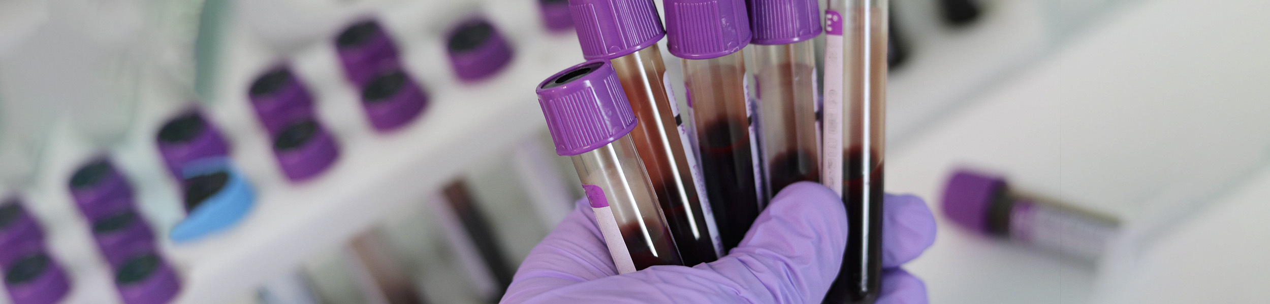 Personalis Next Generation Ctdna Technologies